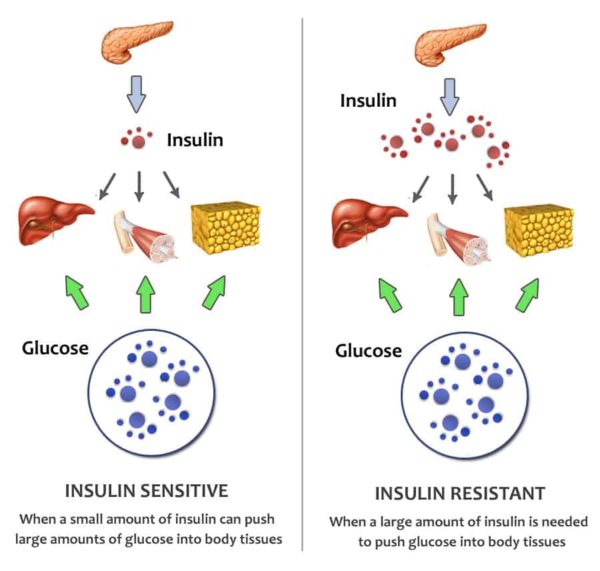 How Dietary Fat Kills Insulin-Producing Beta Cell