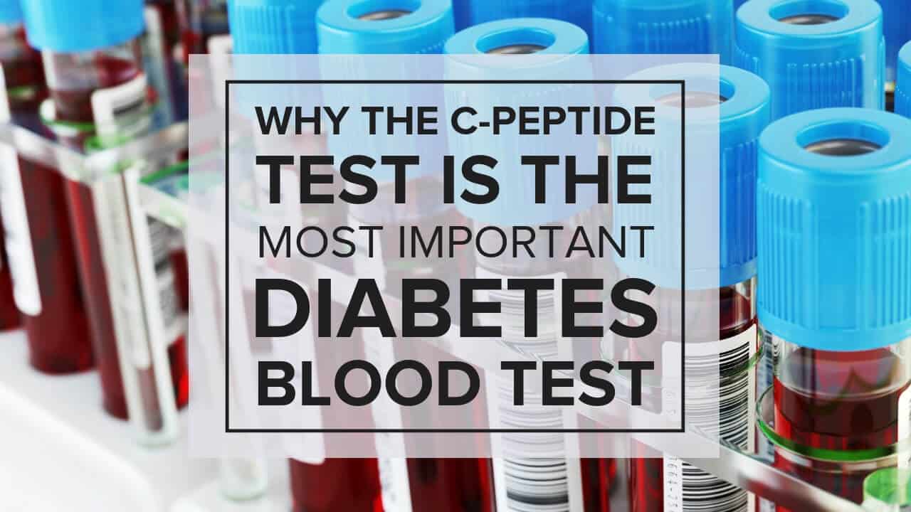 Why the C Peptide Test is the Most Important Diabetes Blood Test