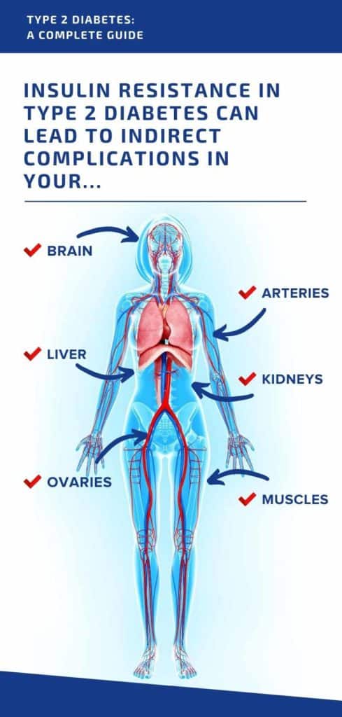 Type 2 Diabetes: A Complete Guide