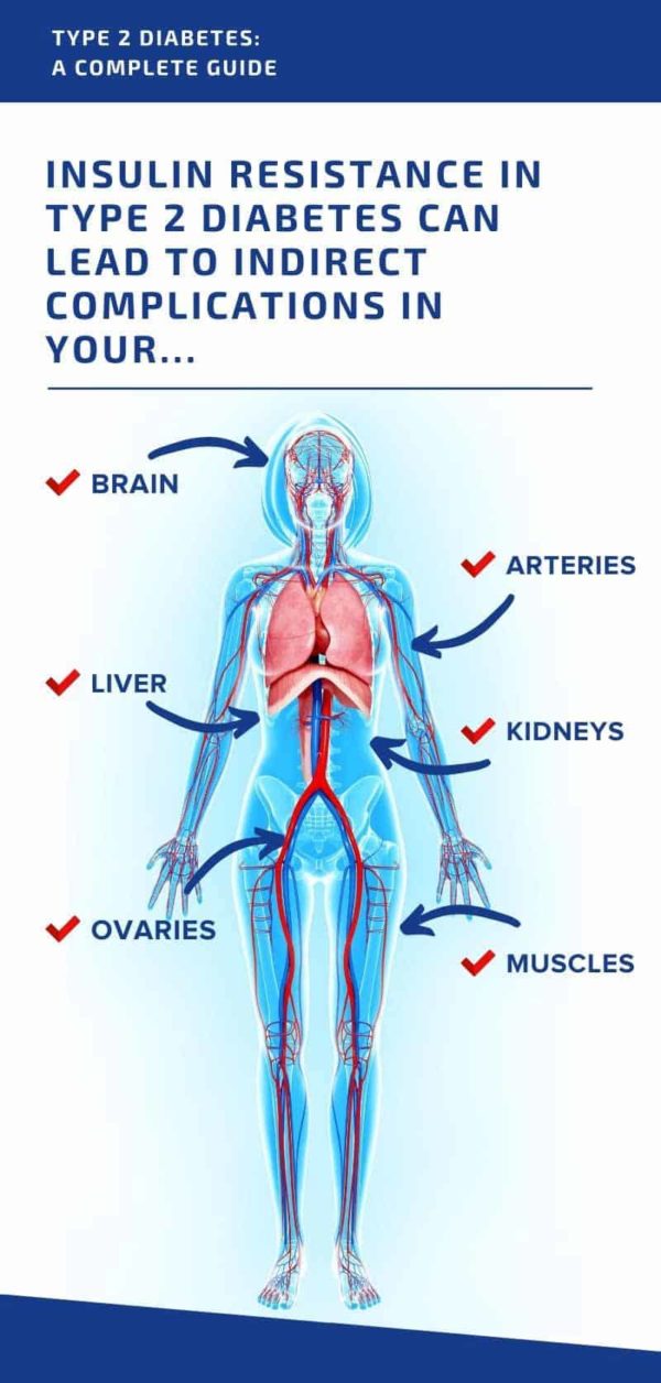 Everything You Need to Know About Type 2 Diabetes
