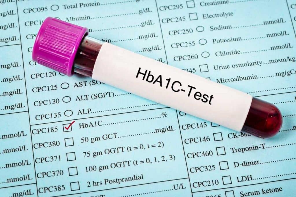 5 Steps to Lower Your HbA1c Fast